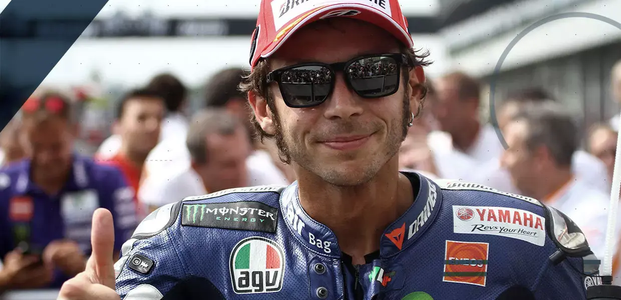 Tibia E Perone Etichettati POLITECNICO DI TORINO